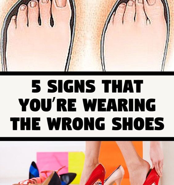5 Signs that you’re wearing the wrong shoes – My WordPress Website