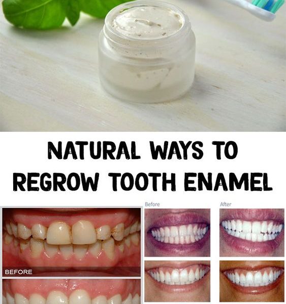 Natural ways to regrow tooth enamel – My WordPress Website